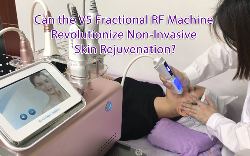 Can the V5 Fractional RF Machine Revolutionize Non-Invasive Skin Rejuv