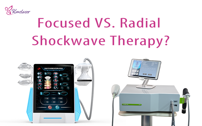 What Is the Difference Between Focused Shockwave and Radial Shockwave